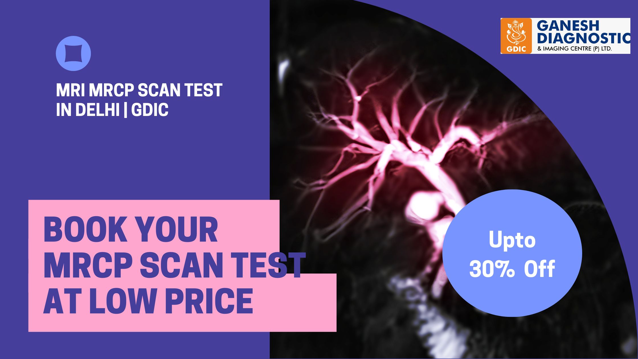 MRI MRCP is a noninvasive imaging test that uses a combination of ...